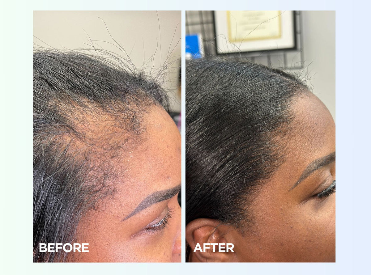 Follicle Booster Gold – TRU-Balance Hair Care